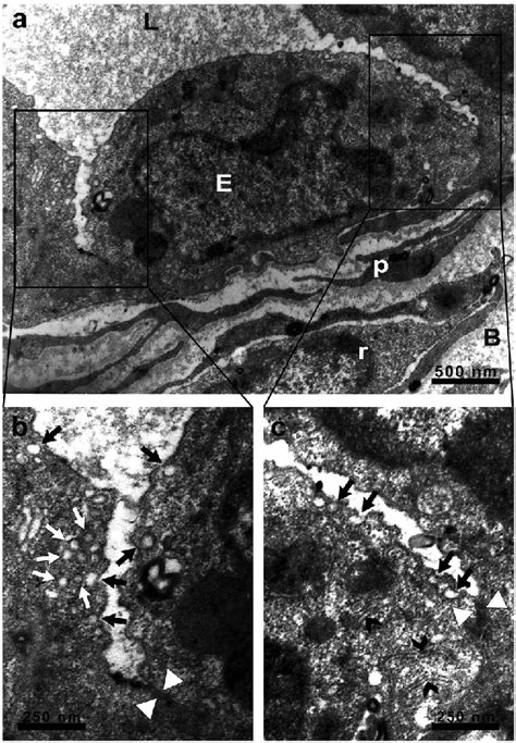 Electron Micrographs Of A High Endothelial Cell In The Lumen Of