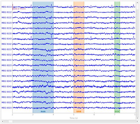 Annotating Continuous Data — Mne 111 Documentation