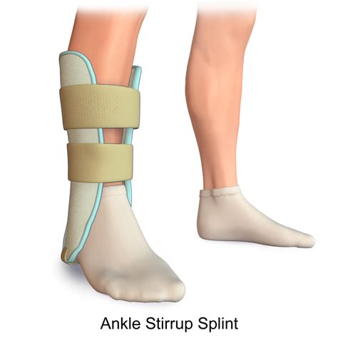 Difference Between Cast And Splint Difference Between