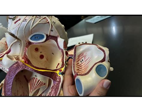 Internal L Atrium Quiz
