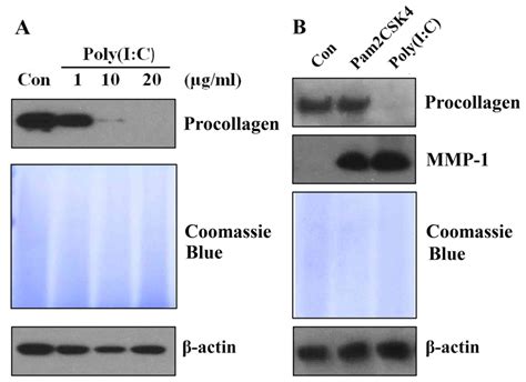 Irf3 Signaling Pathway Serves An Important Role In Polyic Induced