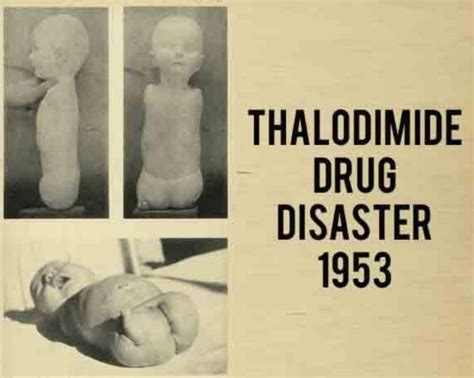 Thalidomide The Tragedy Of Birth Defects And The Treatment Deepstash