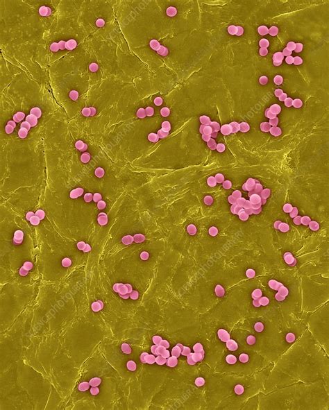 Enterococcus Faecium On Human Skin Sem Stock Image C0321923