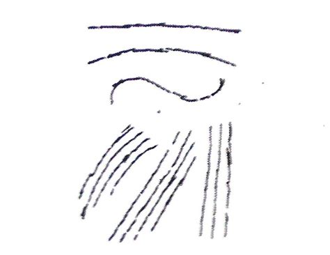 Overview Of Process Bridgman Anatomy Drawings