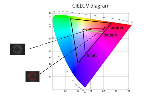 Colour Vision Assessment Metropsis