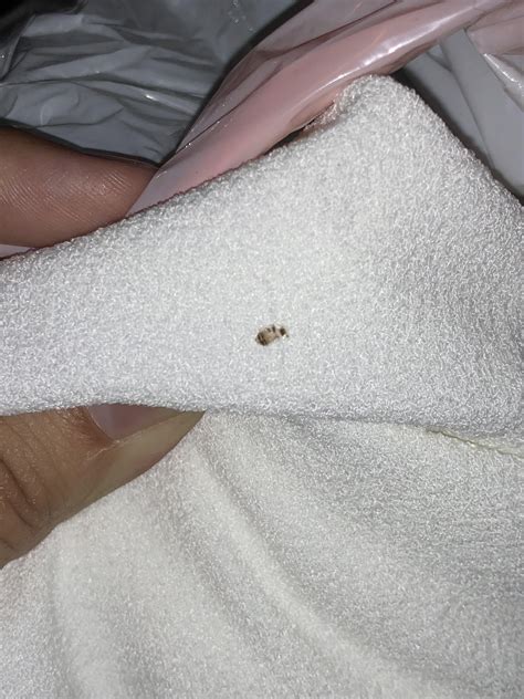 I Found This Bed Bug Exoskeleton On A Dress In My Apartment But The