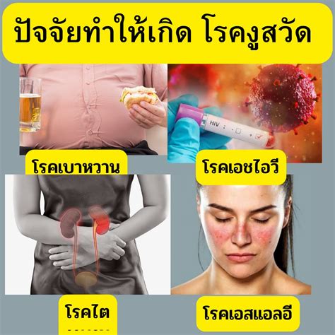 🔥🔥งูสวั ผื่นhiv ตุ่มเอดส์ สะเก็ดเงิน งูสวัด แก้ด้วย Ucore