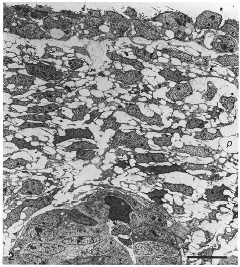 28 Days Pc Spaces As Shown In The Sex Cord Anläge Are The Future