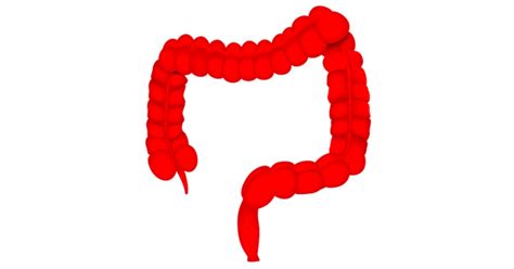 What Is Pancolitis Pancolitis Ibdrelief