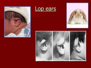 Diseases Of The External Ear Ppt