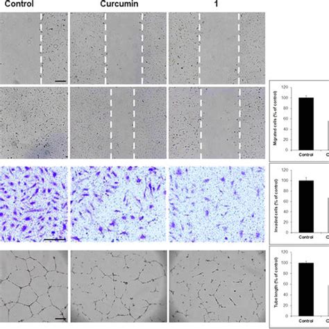 In Vivo Matrigel Plug Assay A Plugs Obtained From Mice 14 D After Download Scientific