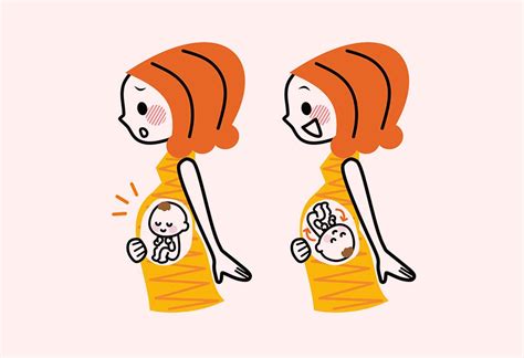 External Cephalic Versionecv Procedure Risks And Success Rate