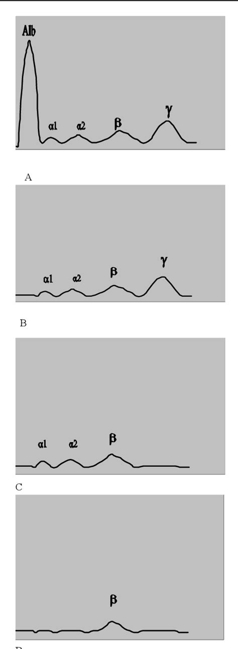 Figure 1 From A New Protocol For Isolation And Purification Of Transferrin From Human Serum