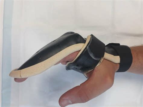 Splints And Casts The Hands Physio Action Rehab