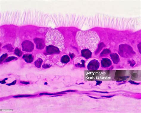 Ciliated Epithelium Labeled