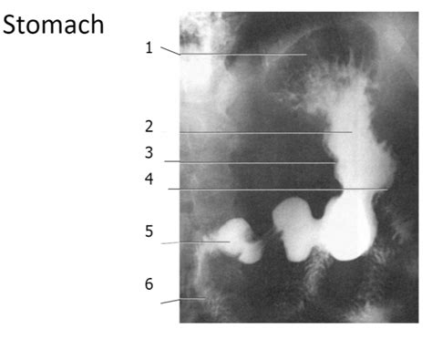 Stomach X Ray Quiz