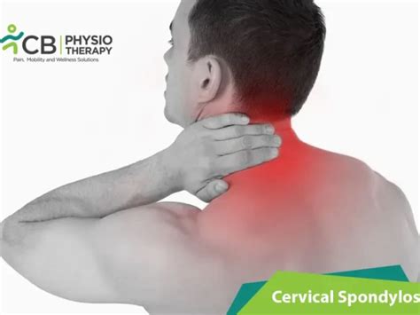 Top 5 Exercises For Cervical Spondylosispng
