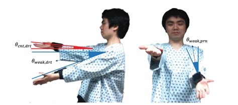 Upper Limb Neurology Examination