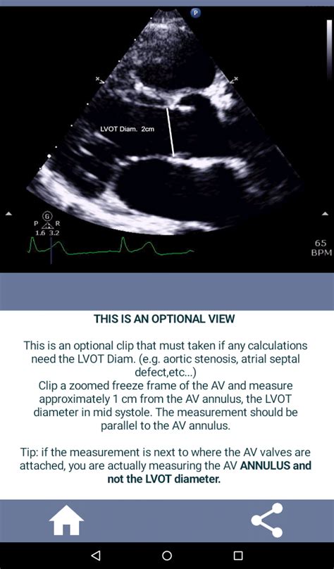 Learn The Full Tte Echo Ultrasound Protocol Appstore For Android