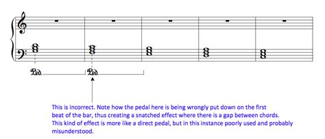 Pedal Markings The Cross Eyed Pianist