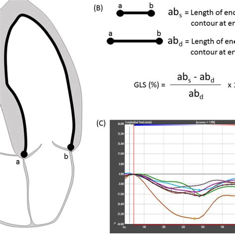 Strain Analysis A Tracing Of Endocardium For Analysis B Strain