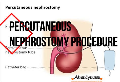 How The Percutaneous Nephrostomy Procedure Is Done Atrendynurse