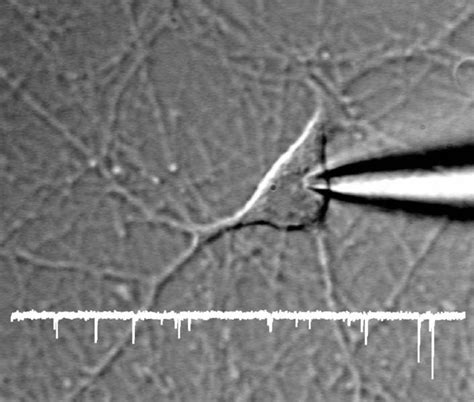 Patch Clamp Electrophysiology