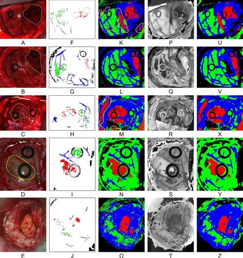 Results Of Each Step Of The Optimized Spatial Spectral Supervised