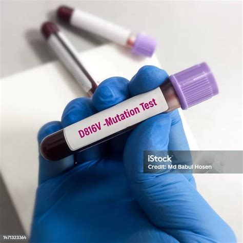 Blood Sample For Kit Mutation Testing To Diagnosis Of Acute Myeloid