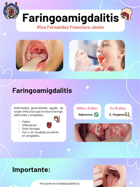 Faringoamigdalitis Pdf Inmunología Enfermedades Y Trastornos