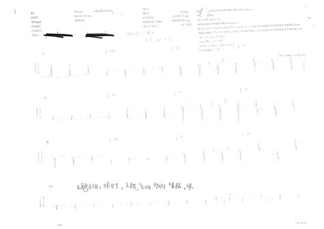 Ecg Signal Detector Object Detection Model By Viktor