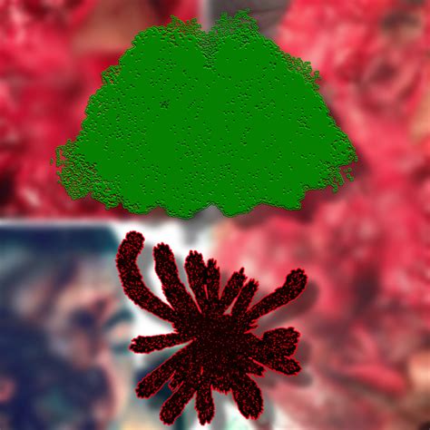 Split With Pseudopseudohypoparathyroidism Nxcx