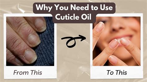 Do You Use Cuticle Oil Everyday At Terri Kent Blog