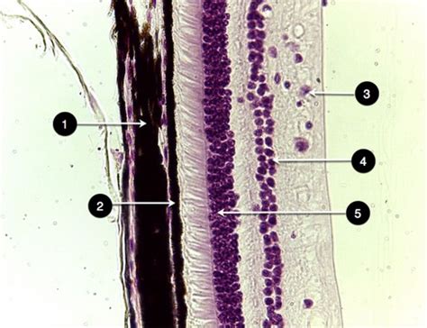 Retina Microscope Slide Flashcards Quizlet