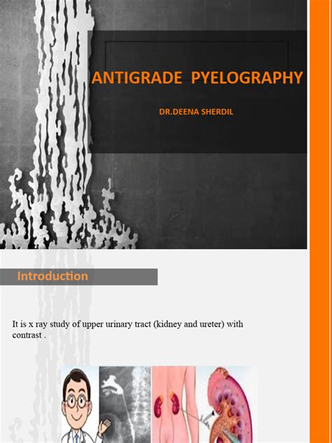 Antigrade Pyelography Procedure Guide Pdf Science And Mathematics