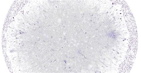 Quintessence Of Dust Protein Space And The Protein Universe Introduction