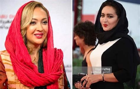 چهره ترسناک و وحشتناک نیکی کریمی بعد از جراحی نیکی کریمی چه بلایی سر خودش آورد