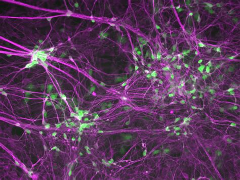 Human Induced Motor Neurons Image Eurekalert Science News Releases
