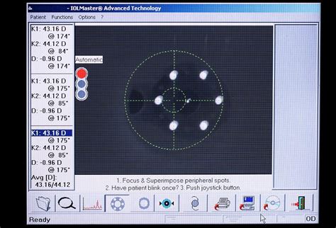 Cataract Surgery Eye Biometry Test Photograph By Jim Varneyscience