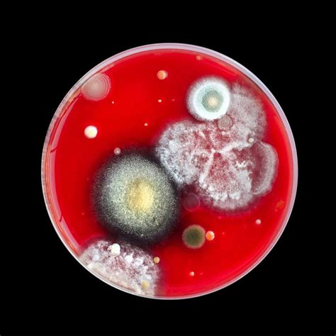 Mold Fungi Colonies Grown From Indoor Air On Blood Sheep Agar Stock