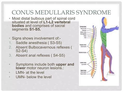 Cauda Equina Vs Conus Medullaris Syndrome Pptx