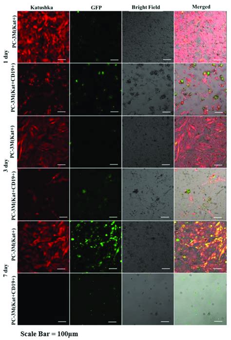 Micrographs Of Pc 3mkat And Pc 3mkatcd19 Tumor Cell Monolayers