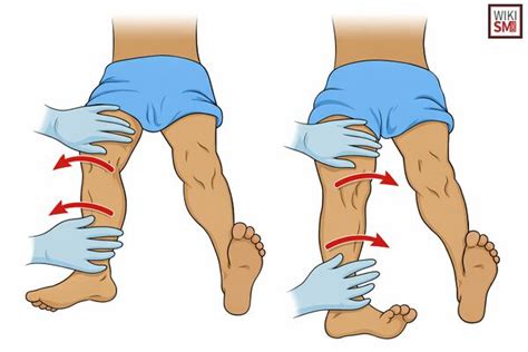 Log Roll Test Wikism Sports Medicine Wiki