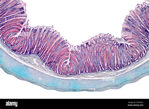 Colon Light Micrograph Of A Section Through The Large Intestine Or