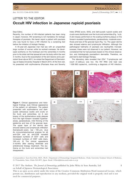 Pdf Occult Hiv Infection In Japanese Rupioid Psoriasis
