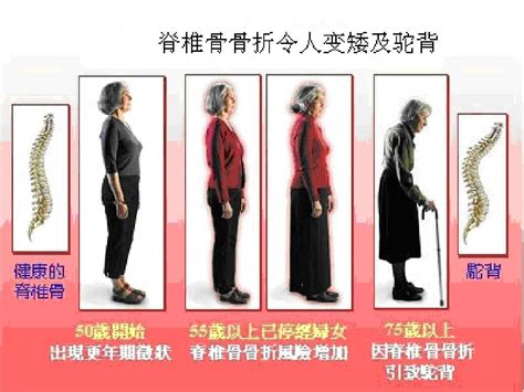 骨骼系统健康知识jword文档在线阅读与下载无忧文档