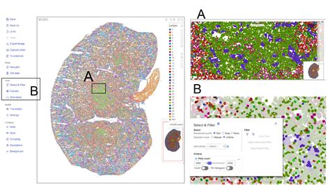 spatial transcriptomics technology high resolution in single cells