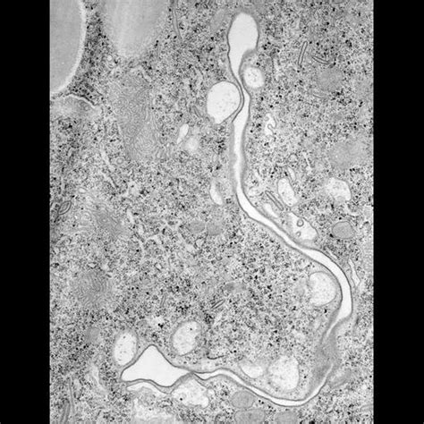 Cil 39177 Paramecium Caudatum Cell By Organism Eukaryotic Cell Eukaryotic Protist Ciliated