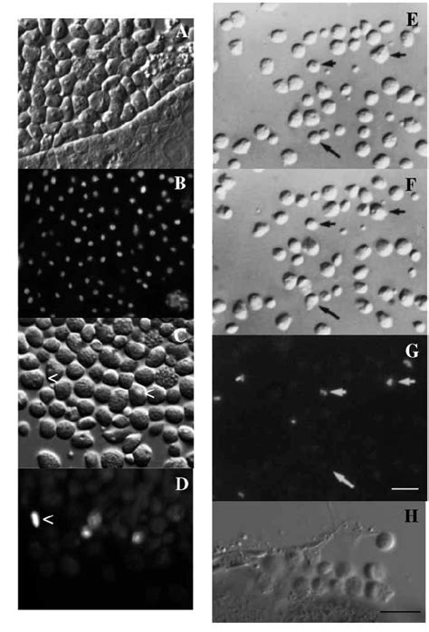 Cellular Morphogenesis Spermiogenesis And Directed Motility Of