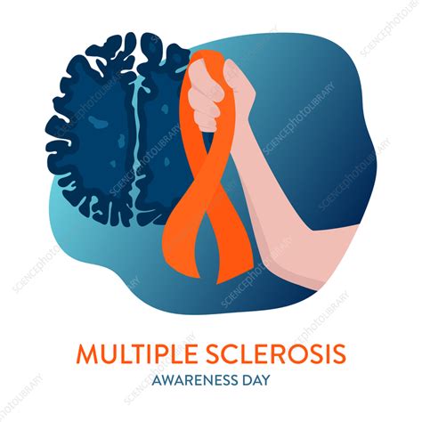 Multiple Sclerosis Conceptual Illustration Stock Image F0350191